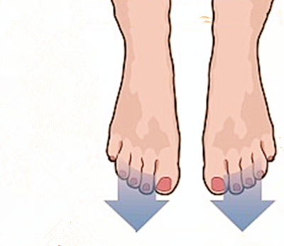 Best Exercises for Fallen Arches to Help You Recover - enkimd